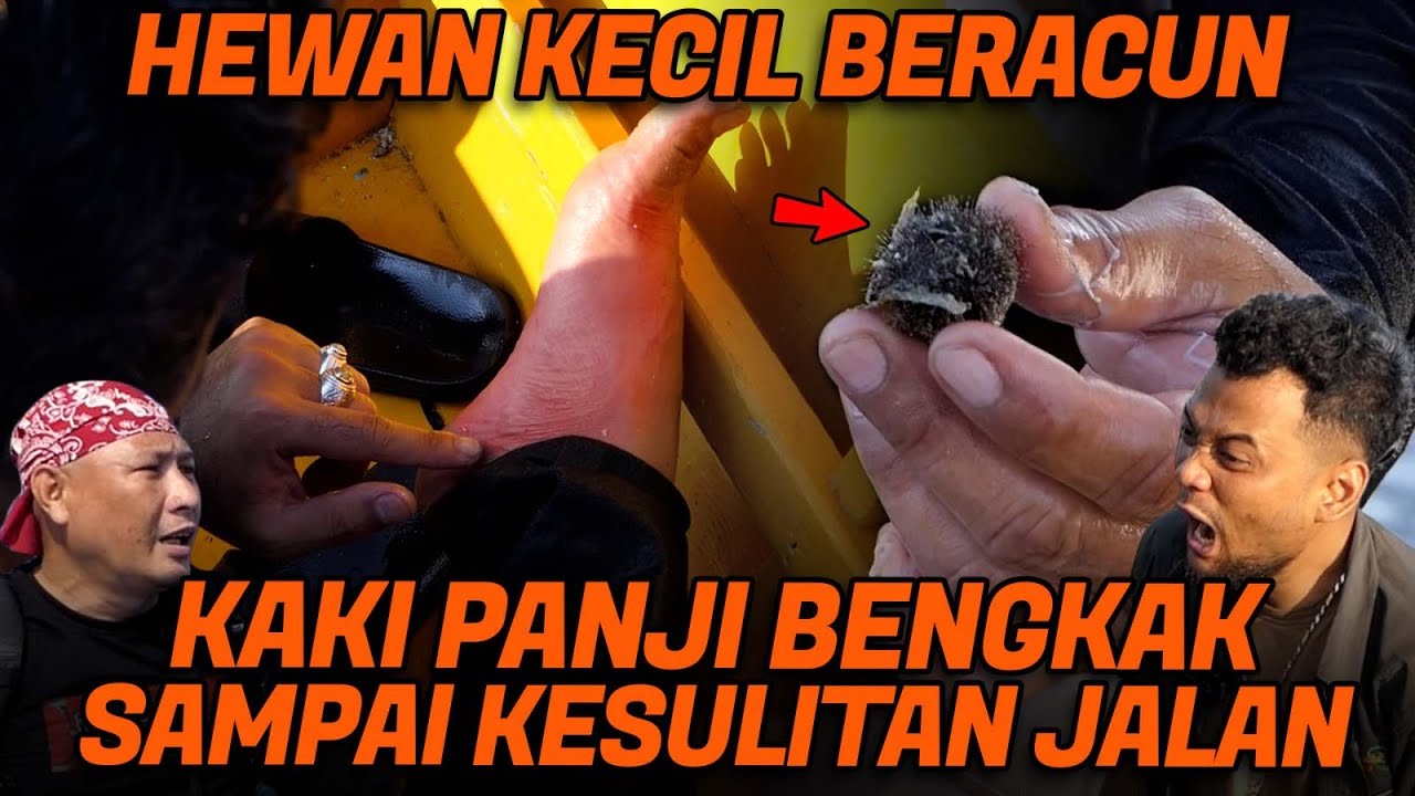 KAKI PANJI BENGKAK KETUSUK BULU BABI SAAT CARI KERANG BAKAU DI PULAU ...