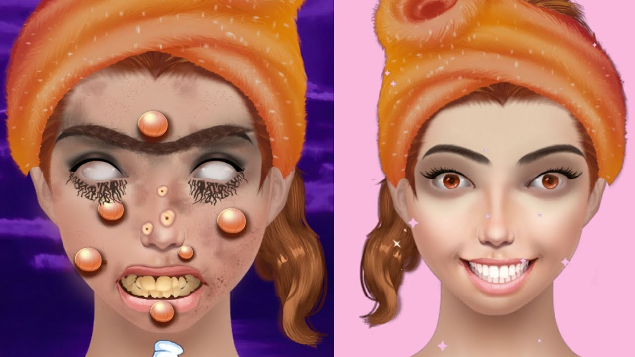 ASMR Chemical peeling skin on face | Dermaplaning Skincare Treatment ...