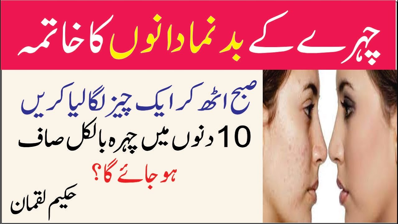Chery Ky Dagh Dhaby Aur Dany | Removal of facial blemishes Chehry k ...