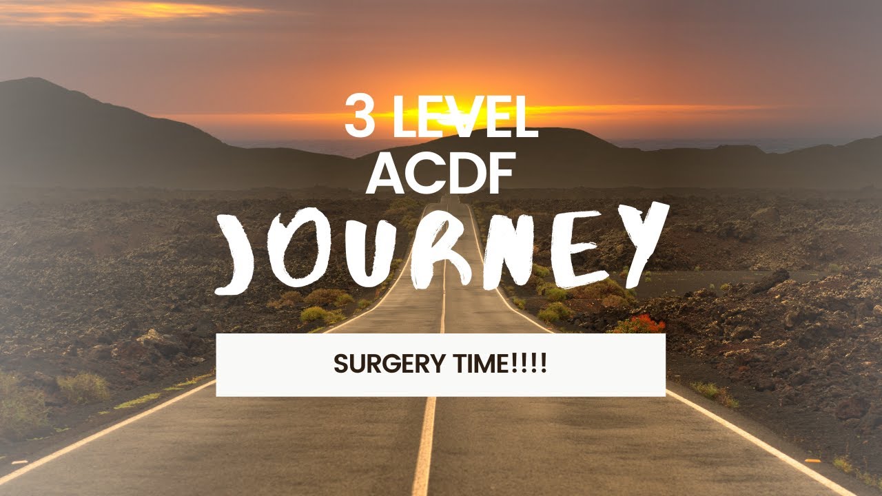 Surgery Time!!! 3 level ACDF Surgery underway!! - YouTube