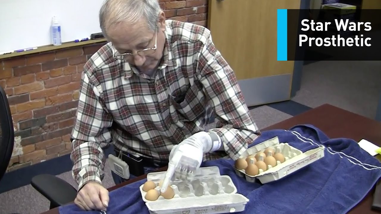 Luke Skywalker's Prosthetic Arm From Star Wars Is Changing The Lives Of ...