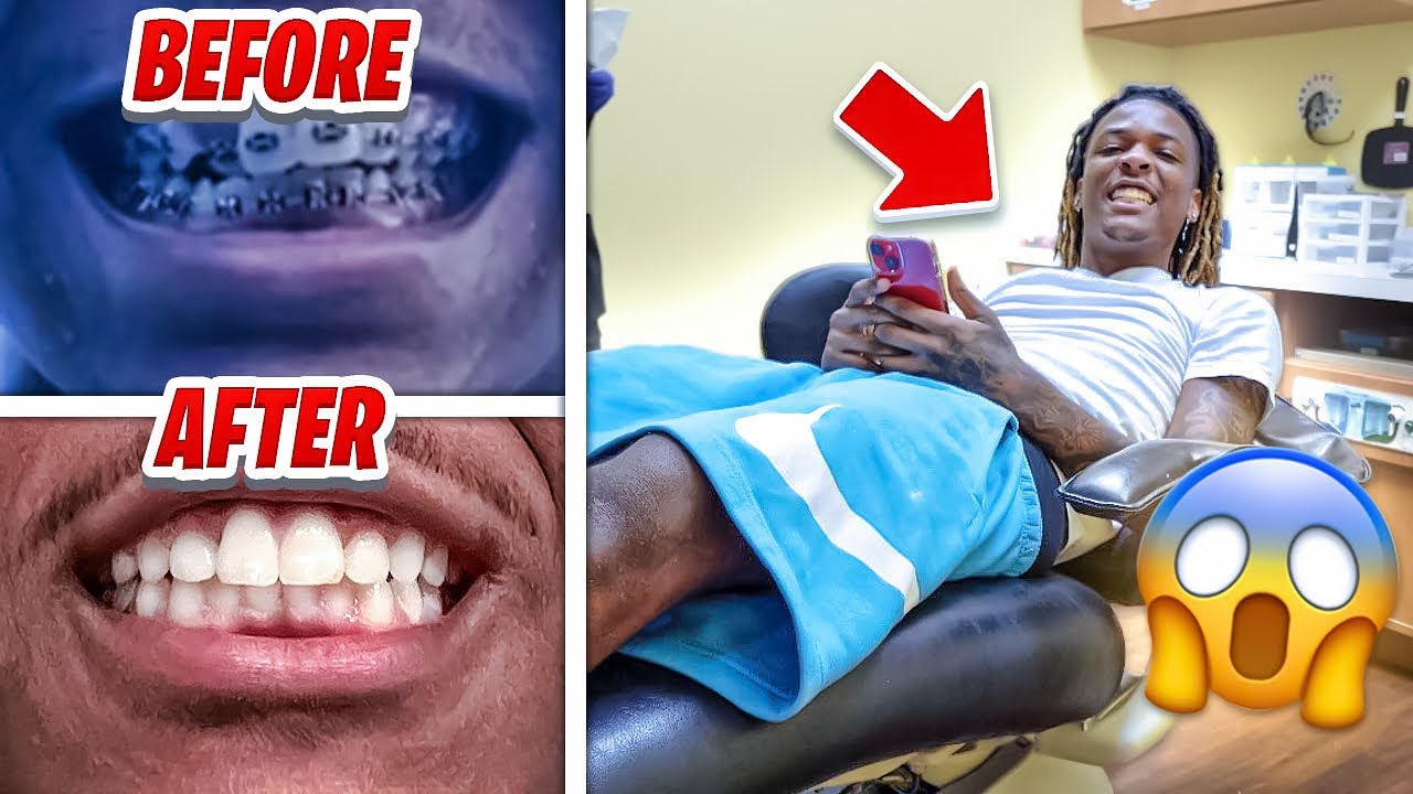 Finally Getting My Braces REMOVED!!! **LIFE CHANGING** - YouTube