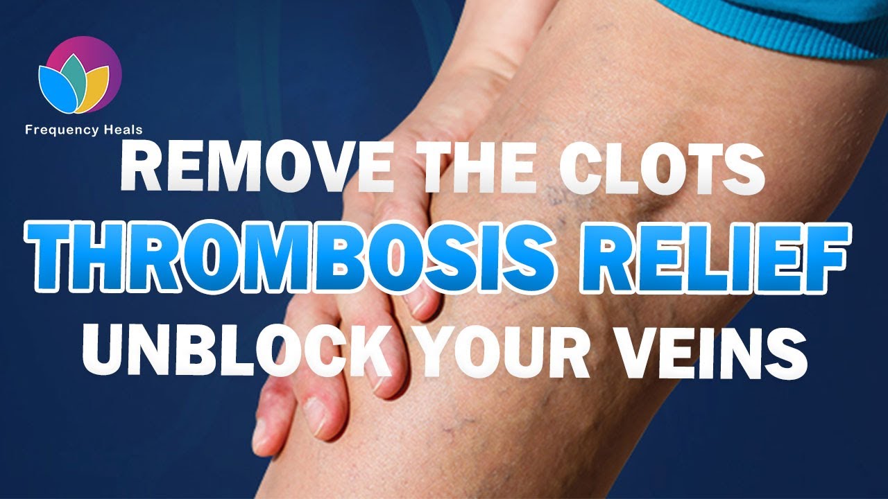 Deep Vein Thrombosis Relief | Remove the Blood Clot & Unblock Your ...