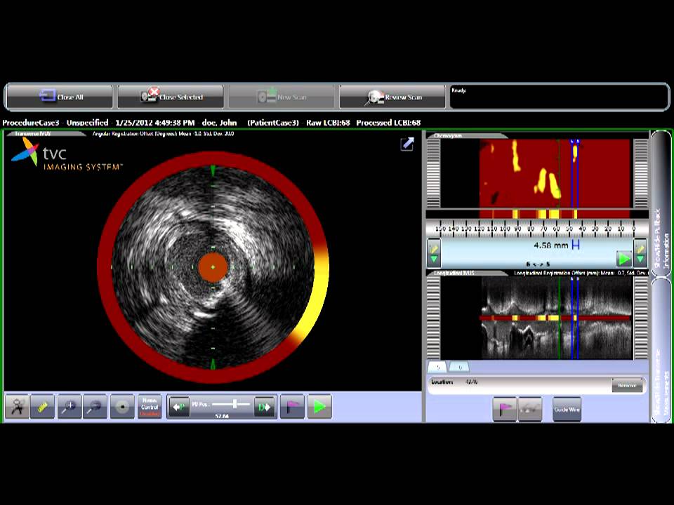 Flagging Tool - YouTube
