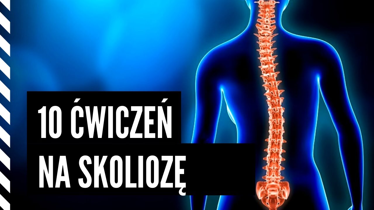 10 Ćwiczeń na skoliozę – przykłady, rodzaje - YouTube