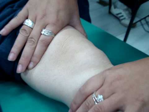 evaluacion clinica fisioterapica I - PRUEBAS DE RODILLA - YouTube