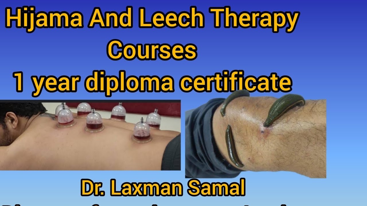 HIJAMA AND LEECH THERAPY COURSES|| balasore|| Dr. Laxman Samal|| speedrecovery Academy - YouTube