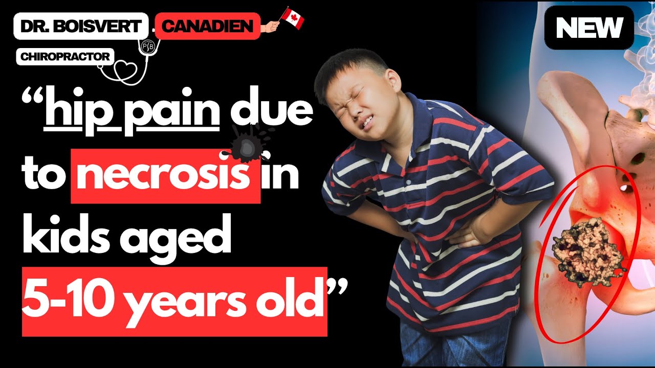 Child Hip Pain: Acetabular Necrosis (Legg-Calvé-Perthes) - YouTube