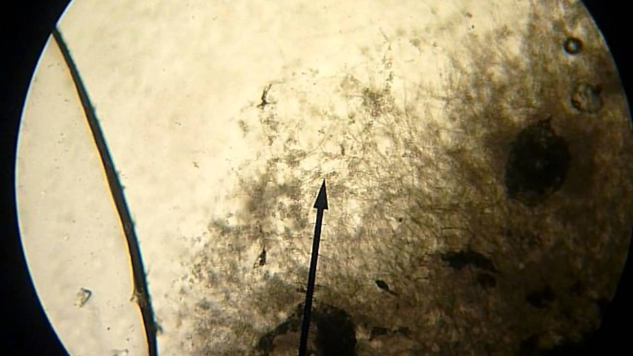 Μικροσκοπική παρατήρηση πρωτοζώων και μυκήτων - YouTube