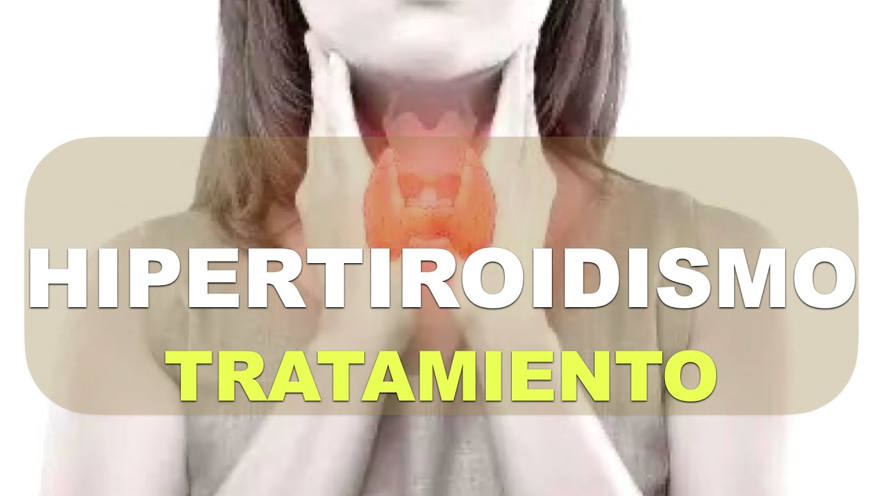 Tratamiento del Hipertiroidismo: Antitiroideos, Yodo Radiactivo ...