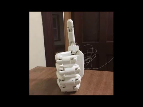Low Cost Prosthetic Hand - YouTube