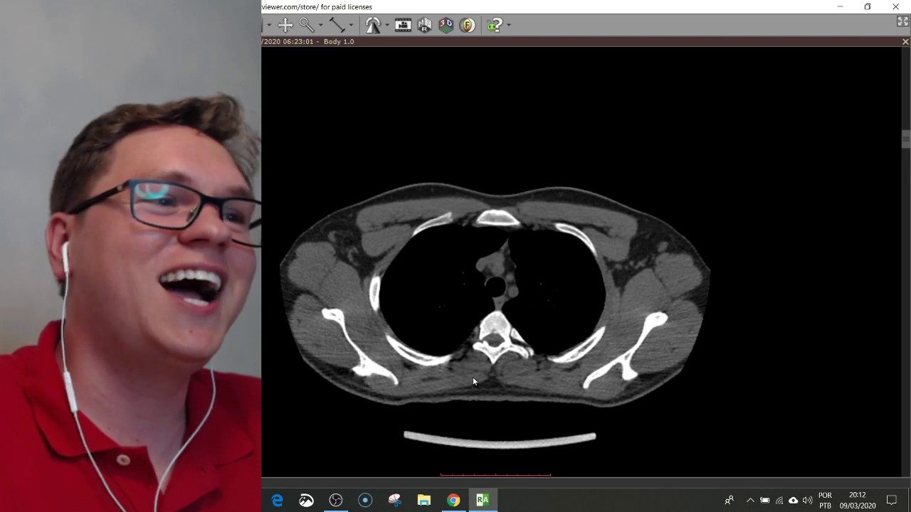 Como Avaliar Uma Tomografia Do TÓrax Anatomia Do Tórax E Sequência Do