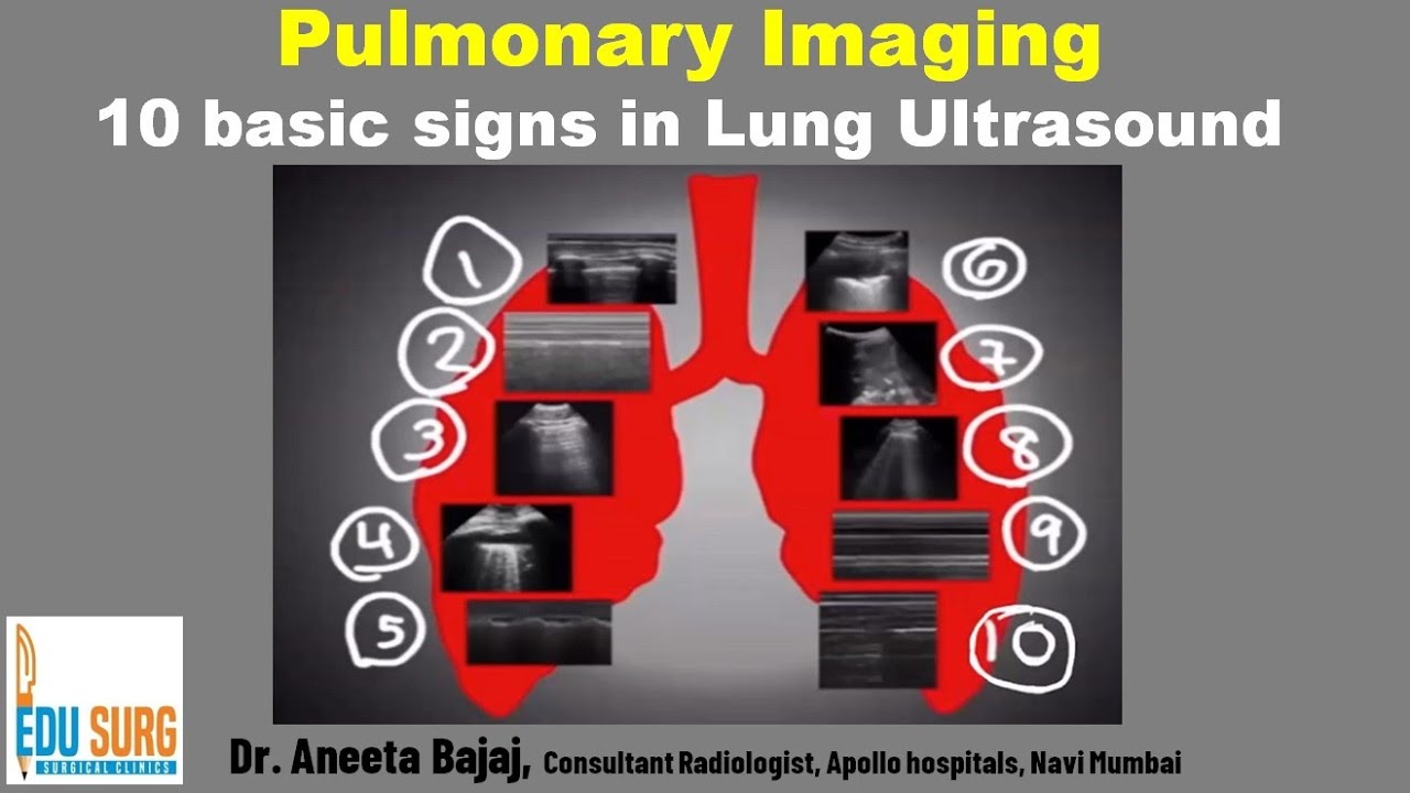 Ultrasound Basics/ pulmonary imaging - Lung ultrasound - Point of care ...