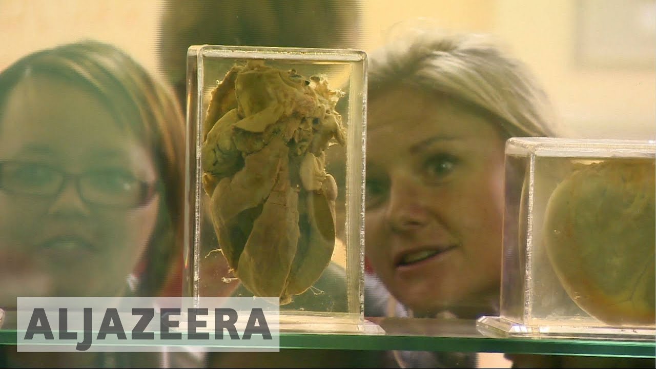 50 years after first successful human heart transplant - YouTube