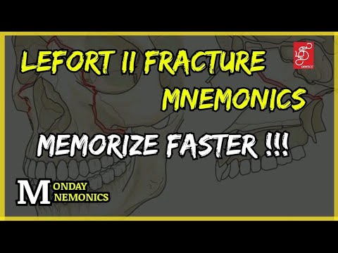 LEFORT 2 FRACTURE MNEMONIC | FRACTURE LINE MNEMONIC | MONDAY MNEMONICS ...