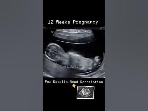 12 Weeks Pregnancy Baby Movements on Ultrasound Scan - YouTube