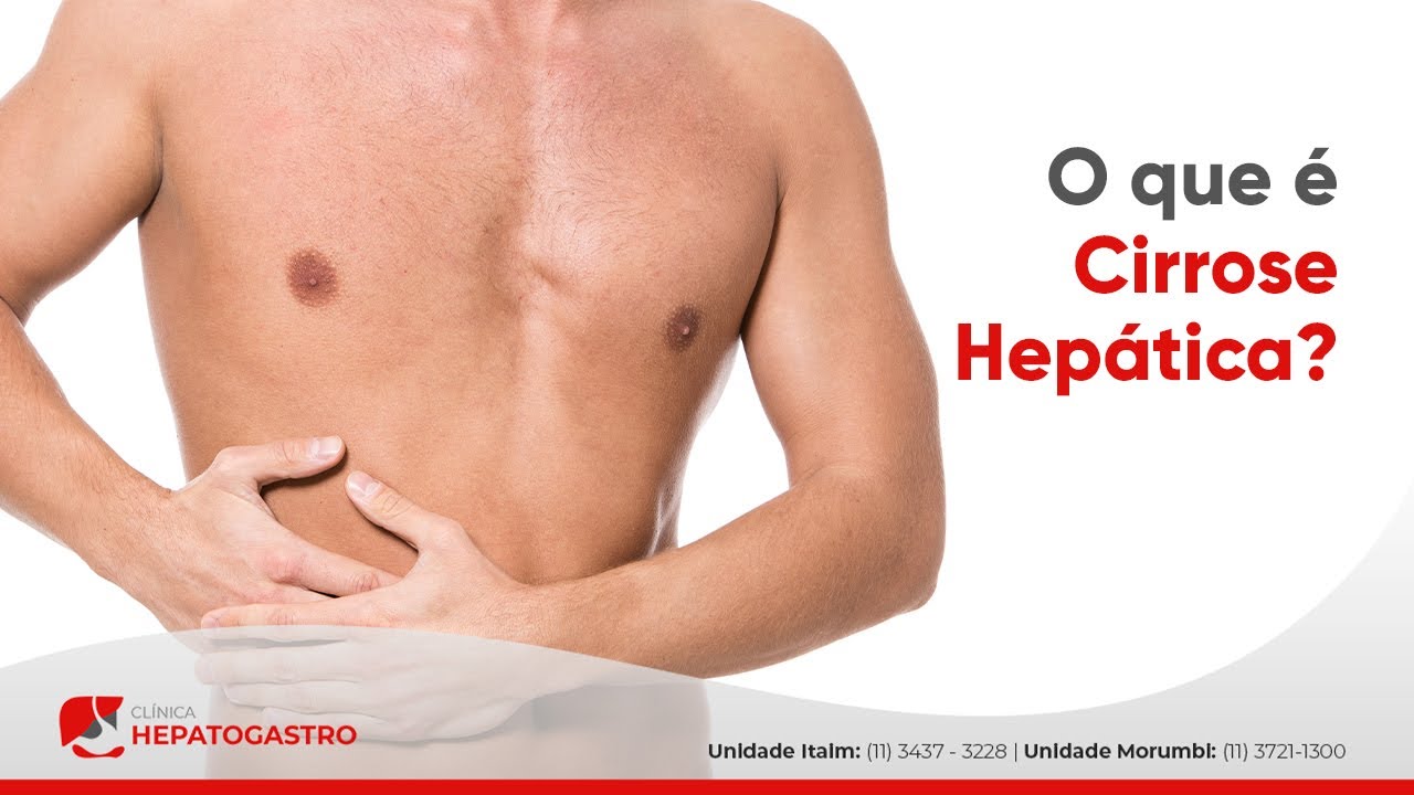 O que é Cirrose Hepática? | Clínica Hepatogastro - YouTube