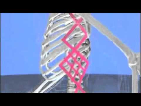 Functional Training- Myofascial Lines - YouTube