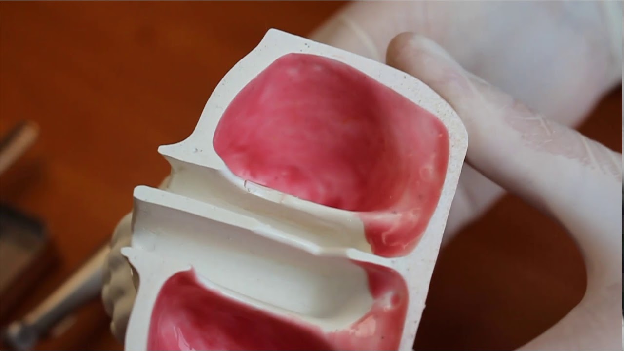 SINUS LIFT using CAS KIT | Sinus Model Hands on | OSSTEM Implant Global ...