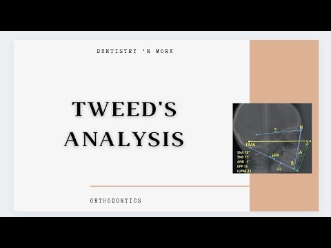 TWEED'S ANALYSIS - YouTube