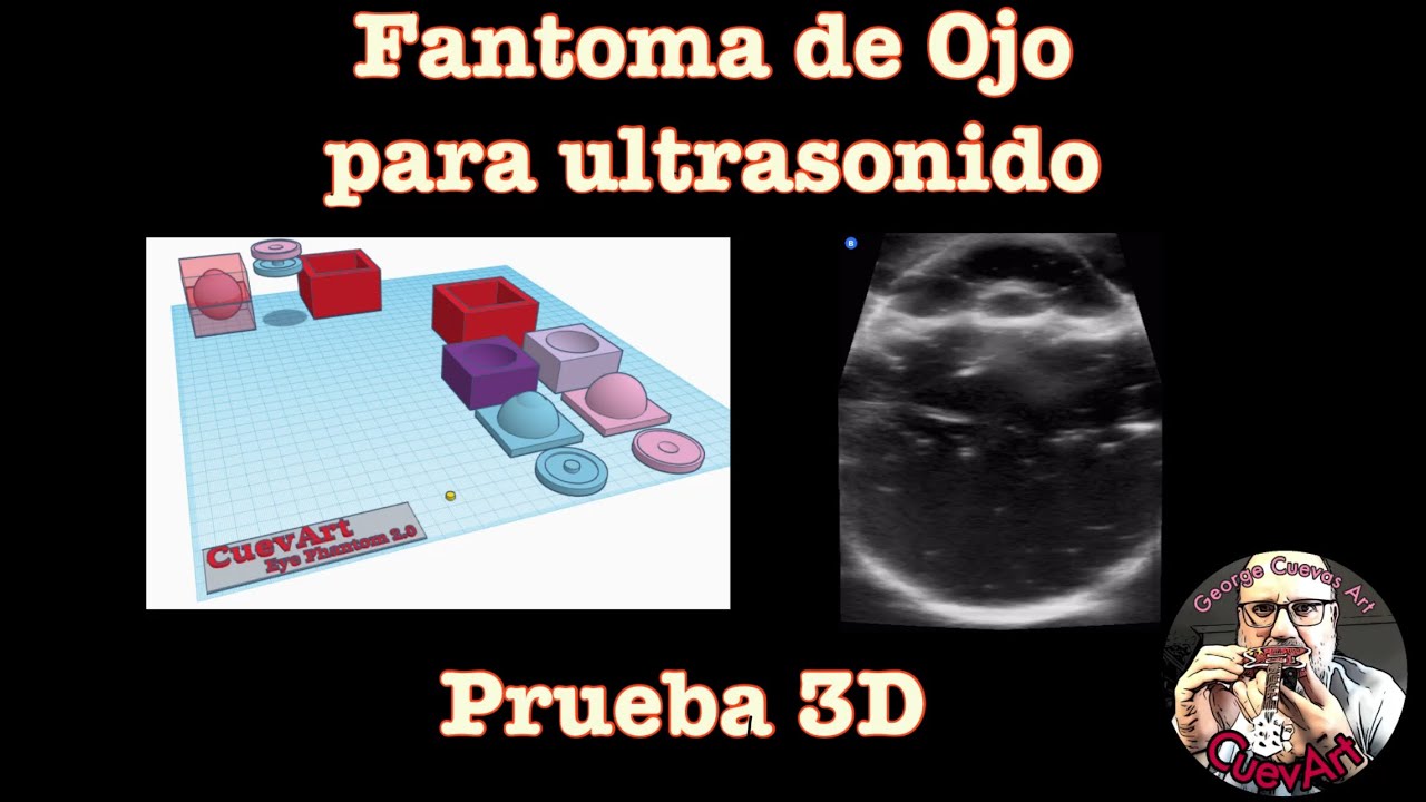 Fantoma de Ojo 3D para ultrasonido / Ultrasound 3D Eye Phantom - YouTube
