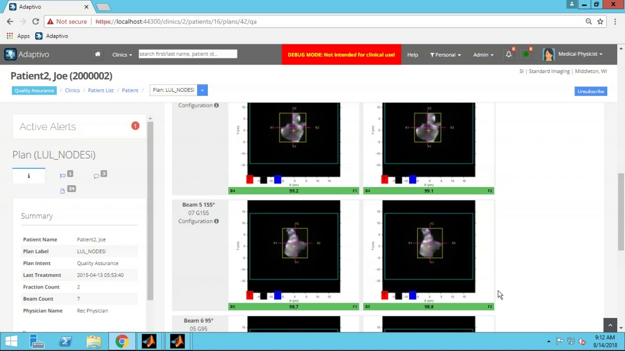 Webinar: Adaptivo - Automatic patient dosimetry software - YouTube