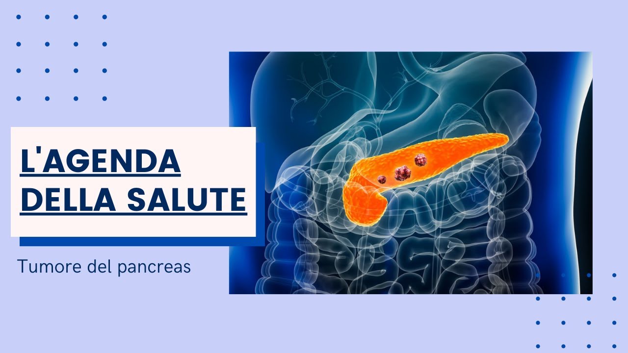 Tumore del pancreas: guarigione possibile solo con la diagnosi precoce ...