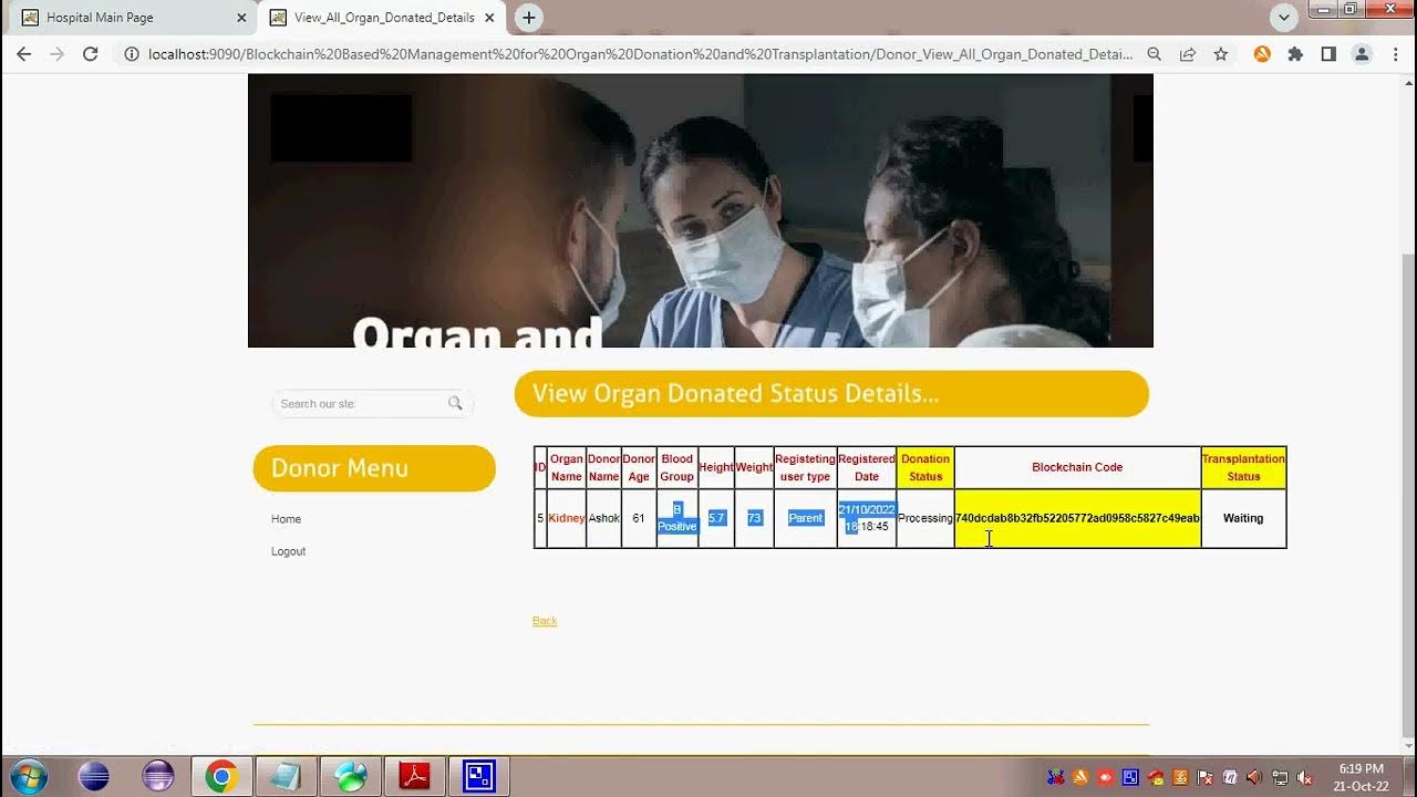 Blockchain Based Management for Organ Donation and Transplantation ...