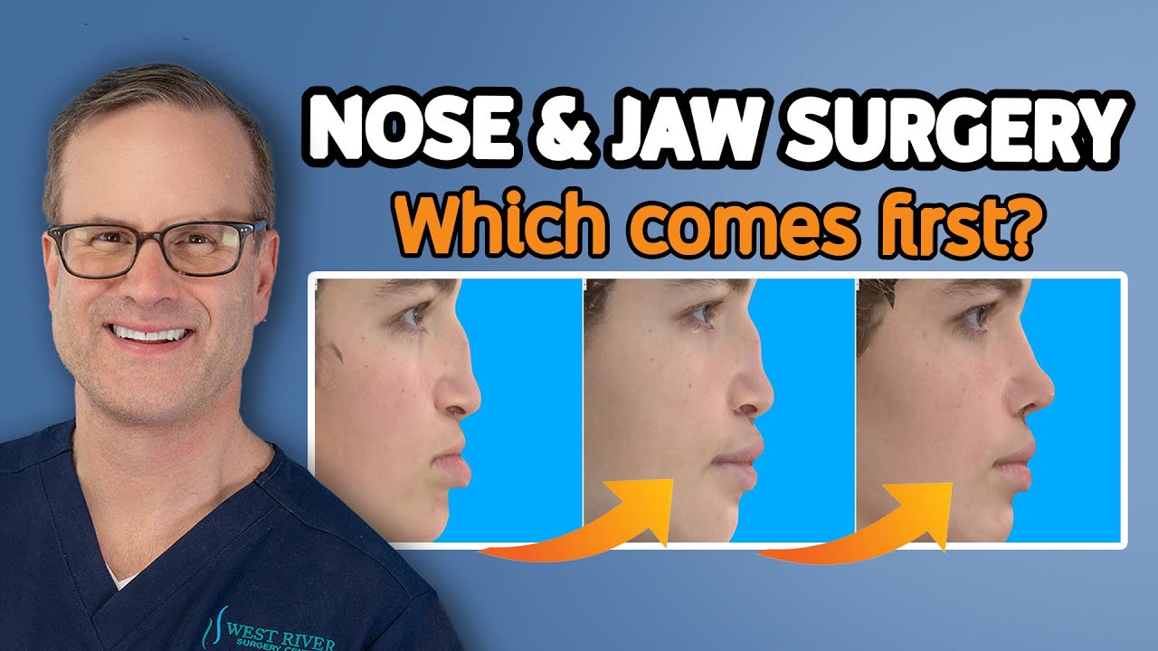 How Jaw Surgery Affects the Nose | Rhinoplasty & Orthognathic Surgery ...