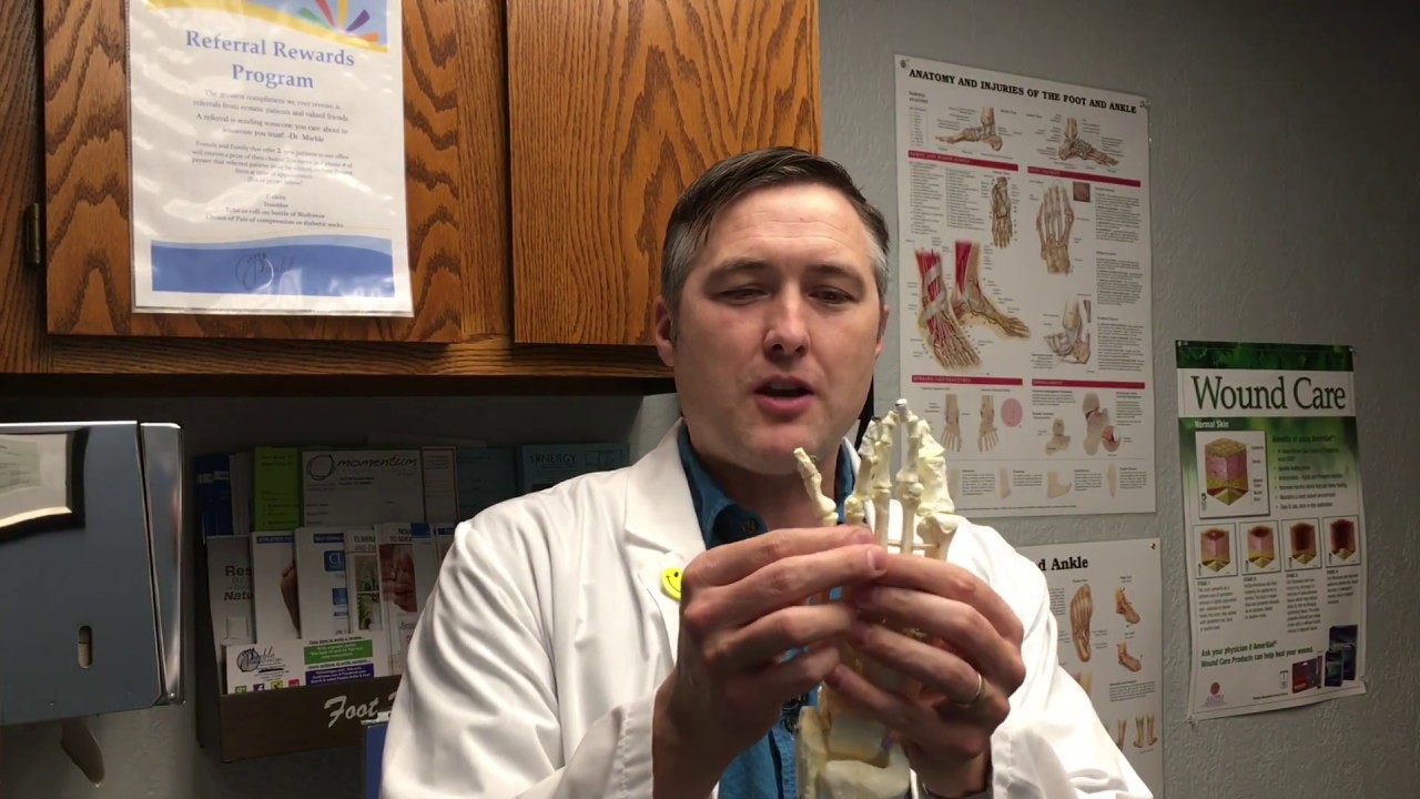What is a Neuroma? Benjamin Marble DPM, Pueblo, CO - YouTube