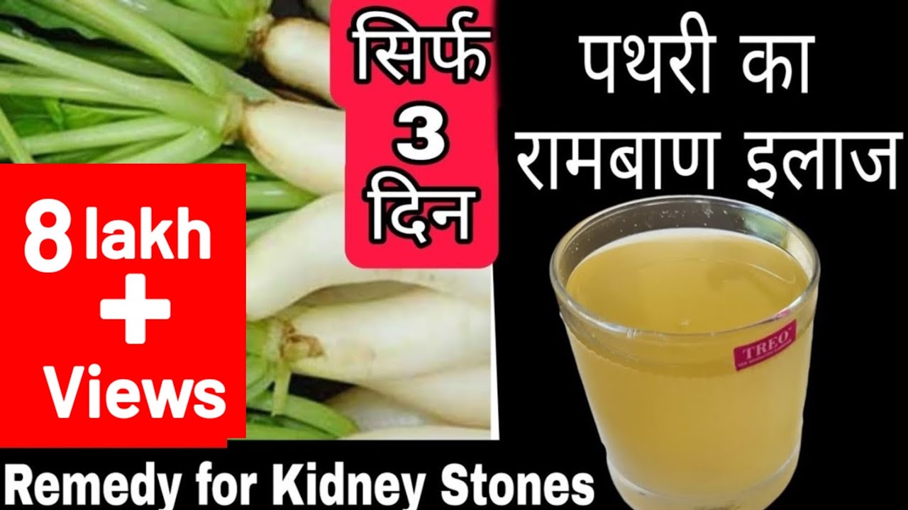 पथरी का घरेलू उपचार | Home Remedy for Stones | Pathari | Cooking logic ...