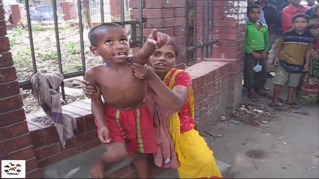 Signs of Rabies in Human - YouTube