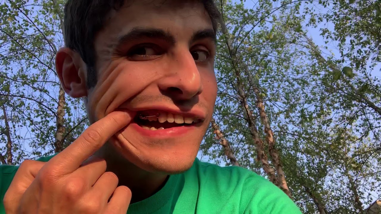 MSE and Facemask? - YouTube