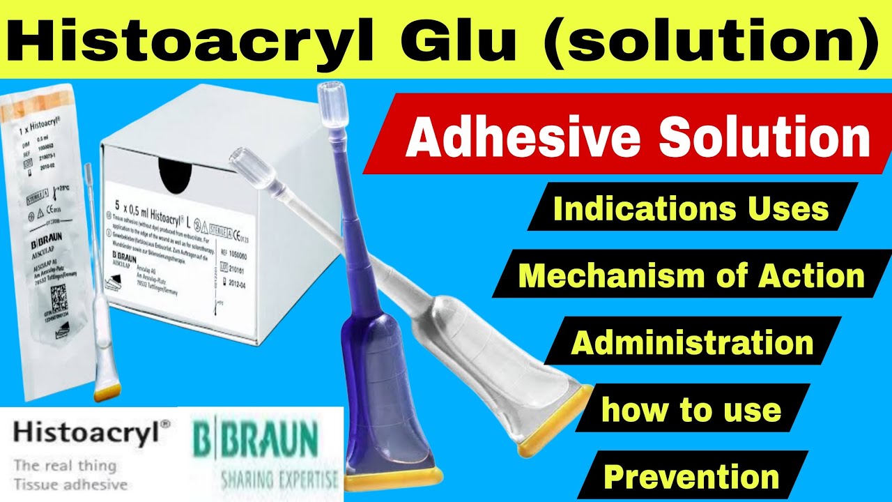 Histoacryl solution | histoacryl 0.5ml | gastric varices treatment ...
