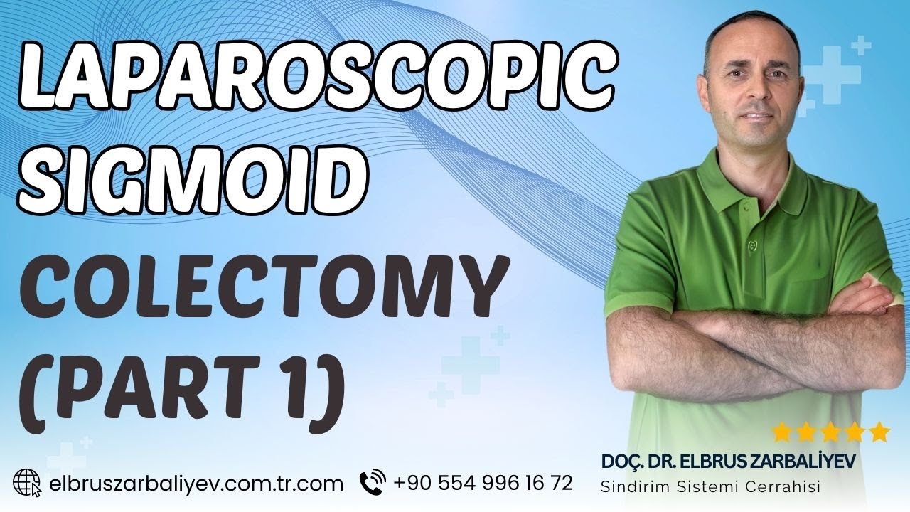 Laparoscopic Sigmoid Colectomy (PART 1) | Doç. Dr. Elbrus Zarbaliyev ...