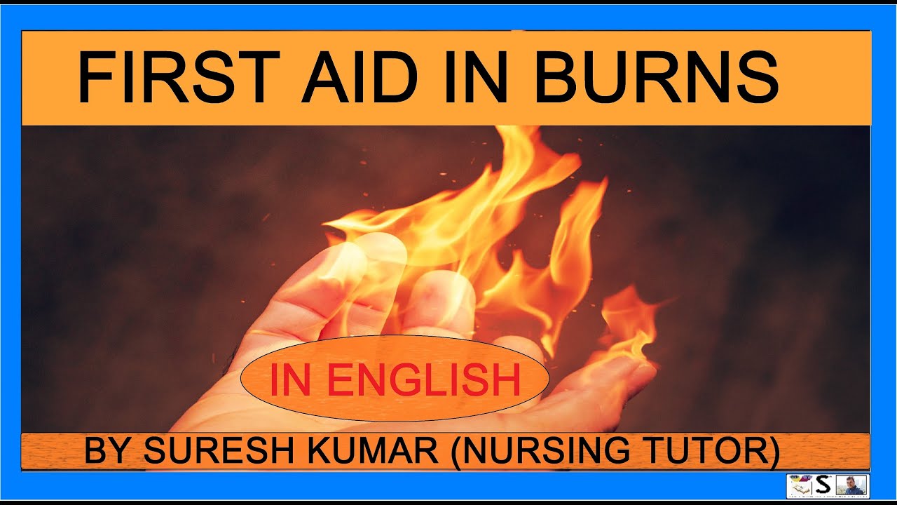 FIRST AID IN BURN | types of burn | rule of nine | what to do in case ...