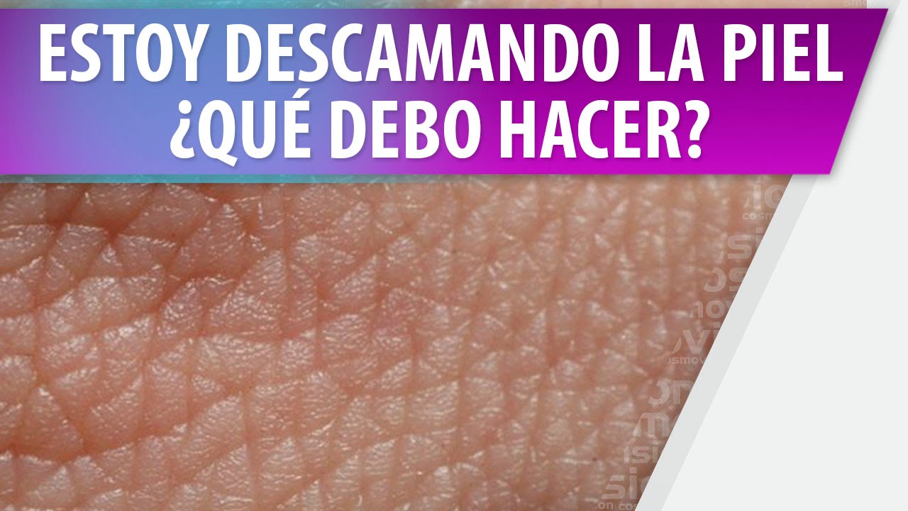 Estoy descamando la piel - Qué debo hacer - YouTube