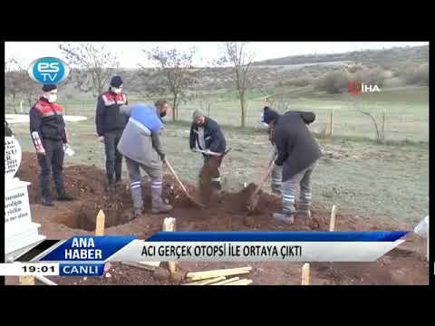 ACI GERÇEK OTOPSİ İLE ORTAYA ÇIKTI