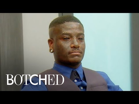 Body Mod Guy Wants to Remove Nipples and Belly Button?! | Botched | E!