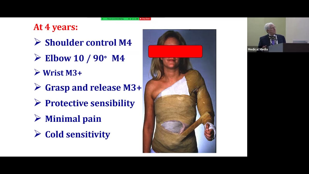 MSKI Visiting Professor L Andrew Koman: Management of Acute Arterial ...