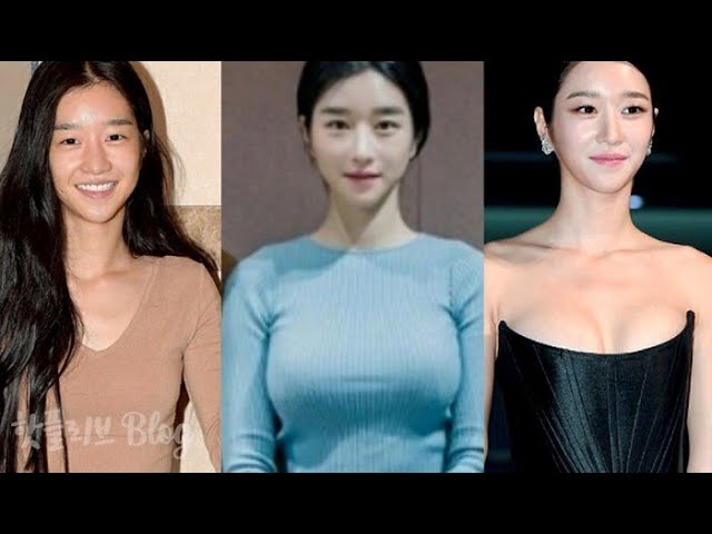 Seohyun Plastic Surgery