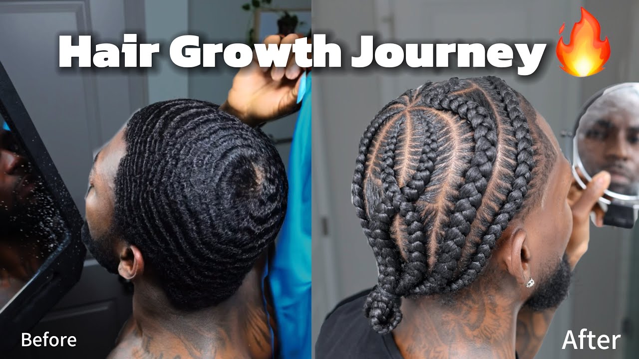 Before & After:My 80-Week Hair Growth Transformation (Full Journey ...