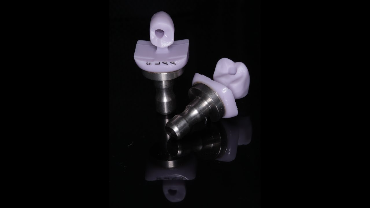 Cementing Cerec Abutment Crown to Tibase - YouTube