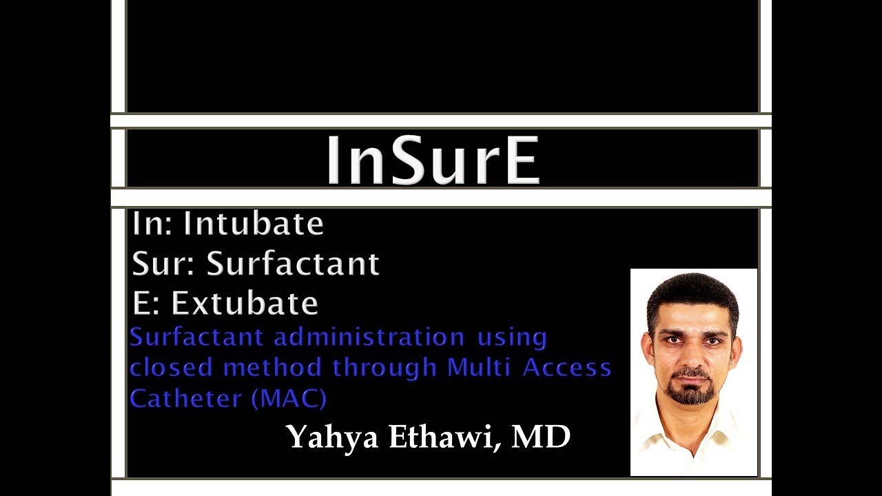 INSURE technique of giving surfactant with my comments - YouTube