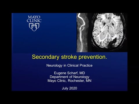 Secondary Stroke Prevention by Eugene Scharf, MD | Preview - YouTube