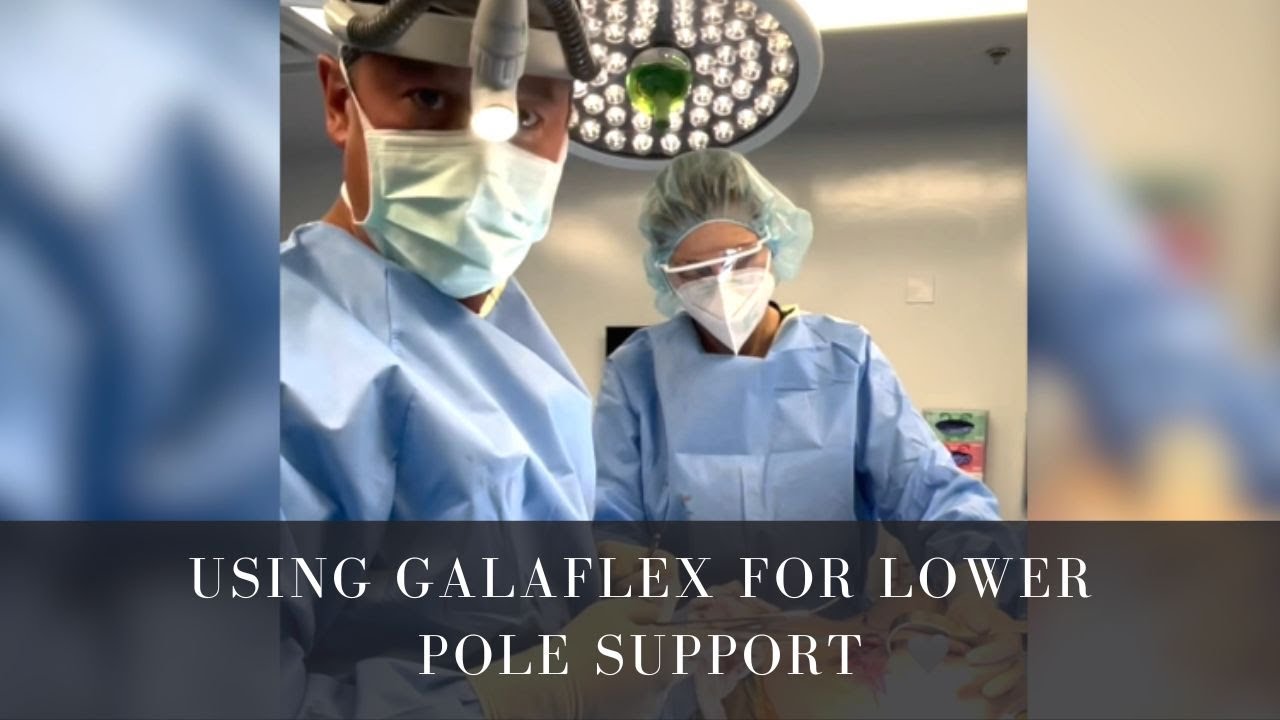 Using Galaflex for Lower Pole Support - YouTube