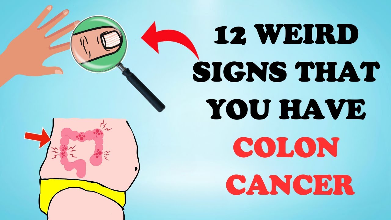 Warning: 12 Weird Signs That Show You're Having Colon Cancer | Winning ...
