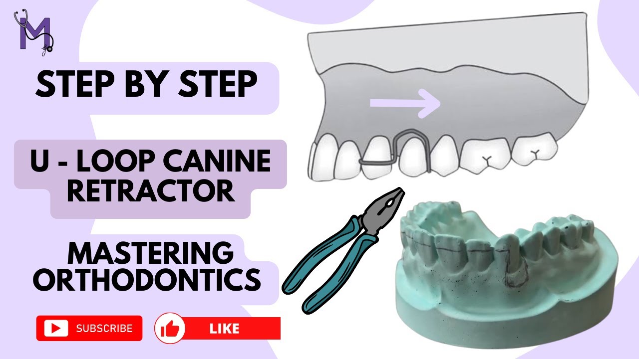 U-Loop Canine Retractor - YouTube