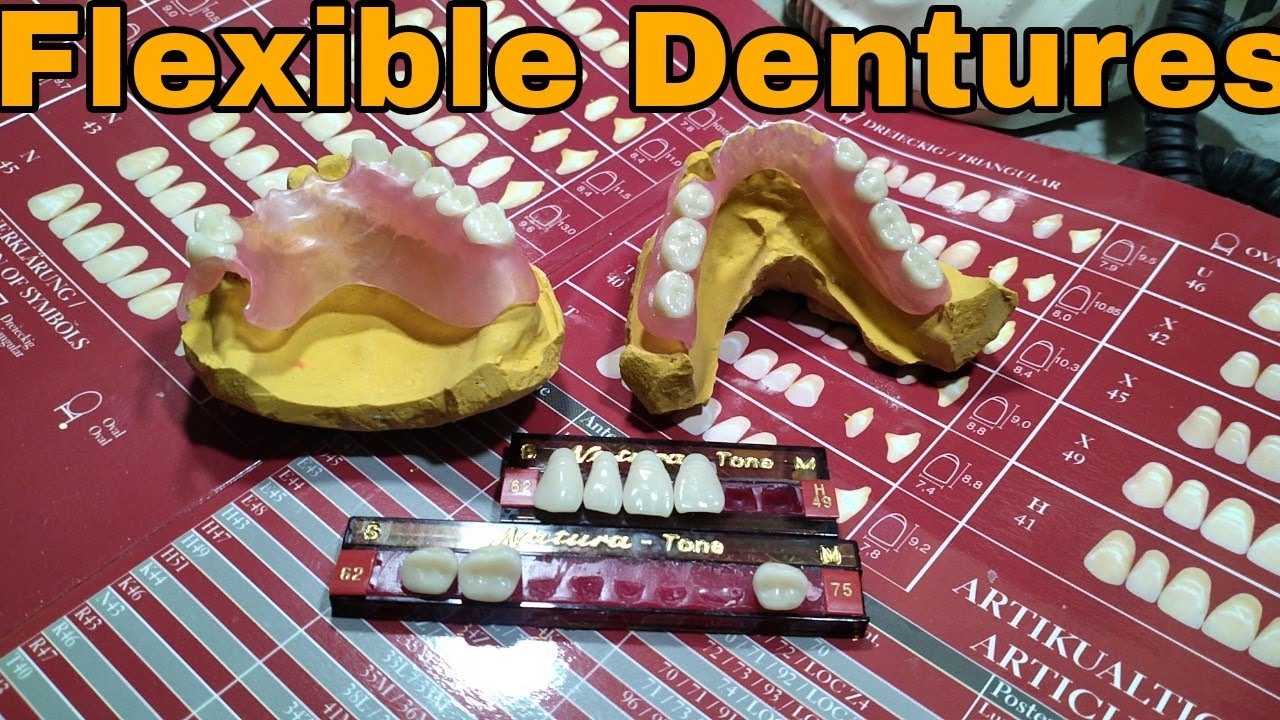 Flexible Dentures Using Naturatone Teeth and Armstrong Flexible ...