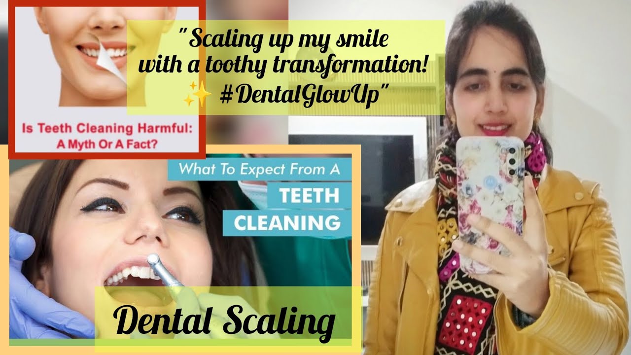 TOOTH SCALING | TOOTH POLISHING| TOOTH BLEACHING| Dental Care Tips ...